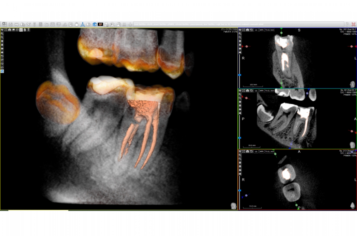 Acteon 3D CBCT rentgen X-MIND Trium 3D CEPH | CBCT a hybridní ...