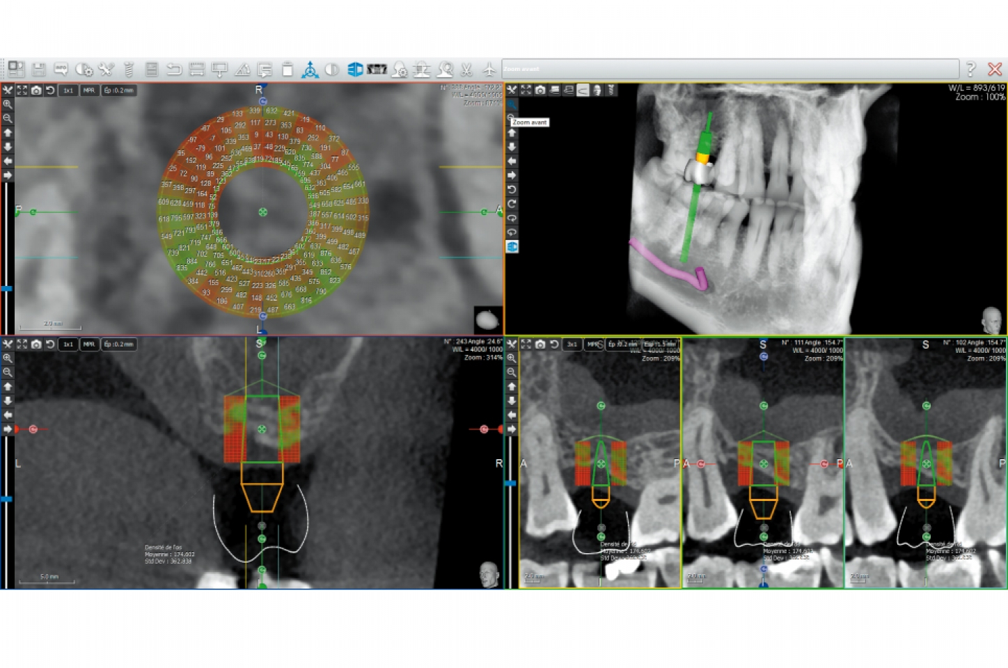 Acteon 3D CBCT rentgen X-MIND Trium 3D CEPH | CBCT a hybridní ...