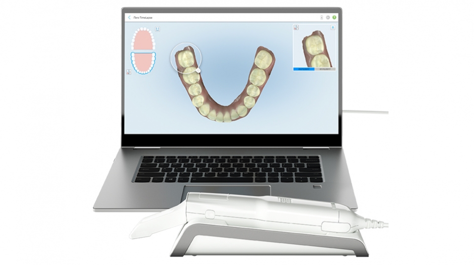 Align Technology intraorální skener iTero Element Flex | Intraorální ...
